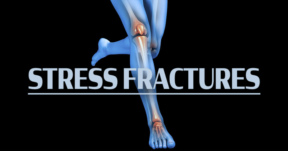 Spring Activity Can Sometimes Bring Stress Fractures - Comprehensive ...
